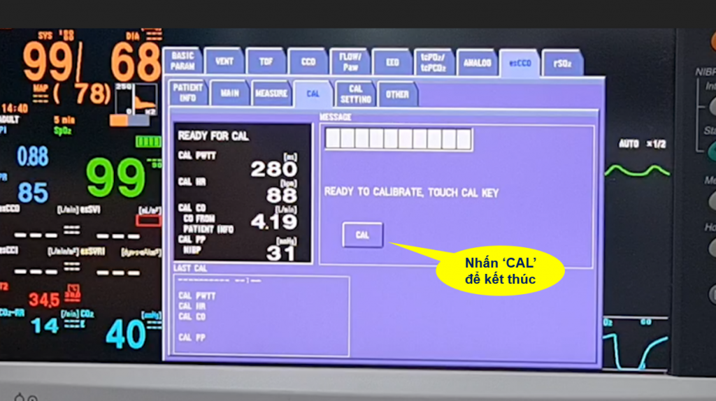 CHỈ SỐ ESTIMATED CONTINUOUS CARDIAC OUTPUT / esCCO. - GÂY MÊ HỒI SỨC